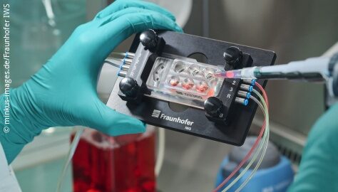 Miniature labs: Insights into the development of metastases